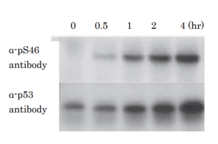 Anti-p53 (phospho Ser46) Antibody [#36] (A401) | Antibodies.com