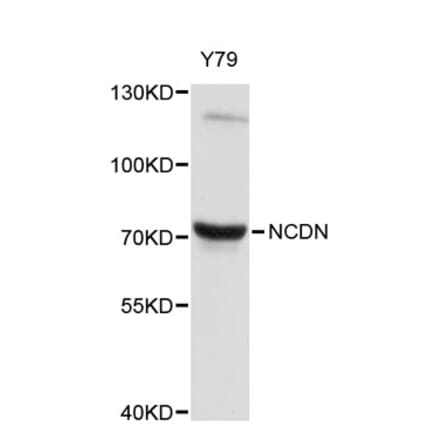 Neurochondrin Antibodies | Antibodies.com