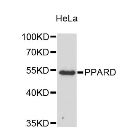 KLF17 Antibodies | Antibodies.com