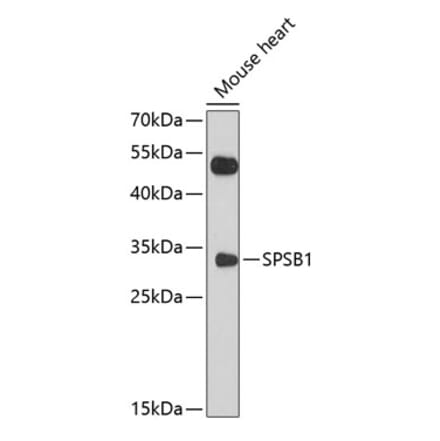 SPSB1 Antibodies | Antibodies.com