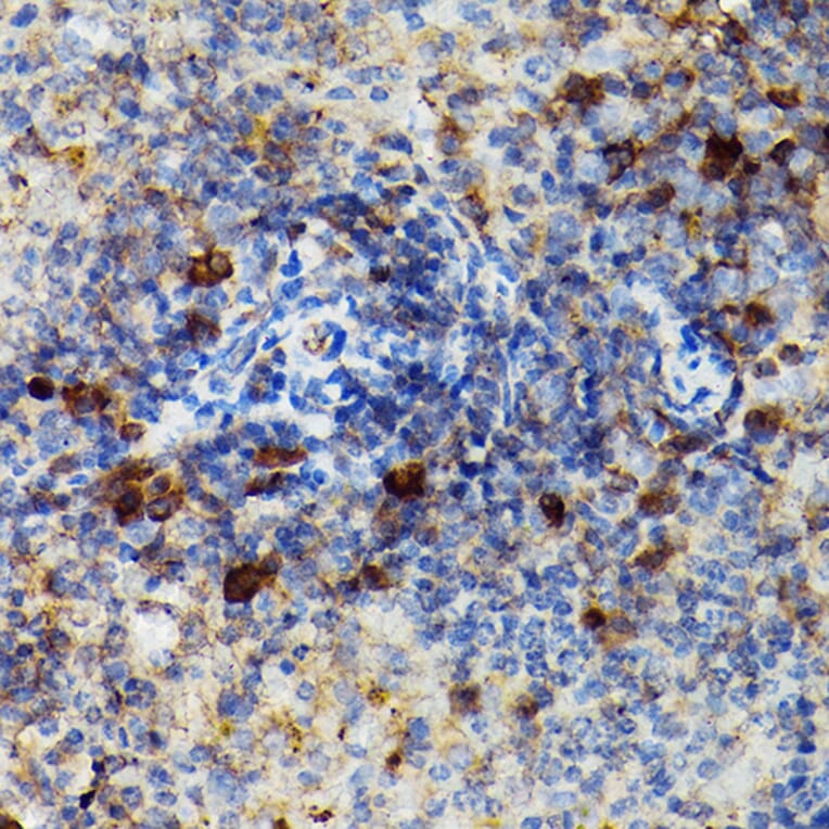 Anti-Granzyme B Antibody (A11541) | Antibodies.com Anti-Granzyme B Antibody (A11541) | Antibodies.com