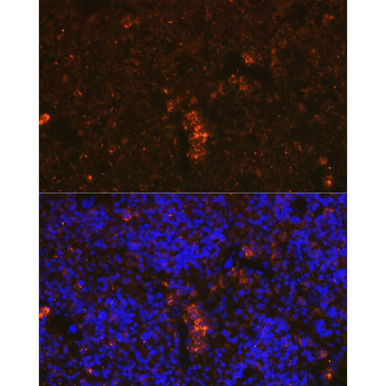 Anti-Granzyme B Antibody (A11541) | Antibodies.com Anti-Granzyme B Antibody (A11541) | Antibodies.com