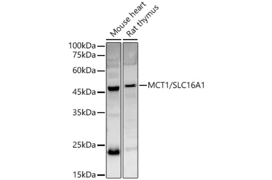 Anti-MCT1/Monocarboxylic acid transporter 1 Antibody (A11599)