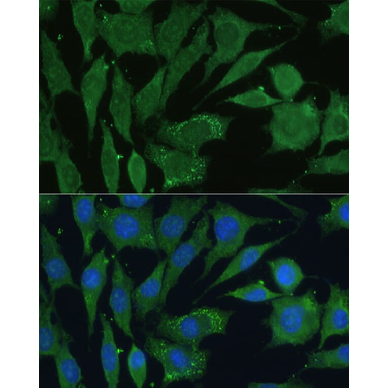 Anti-CGRP-1 Antibody (A11847) | Antibodies.com