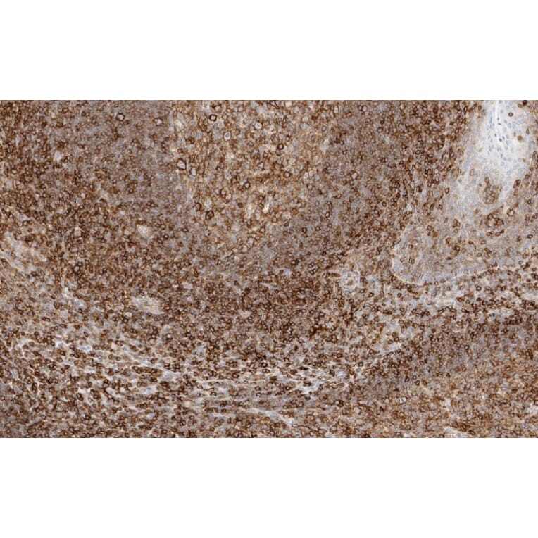 Anti-HLA Class I Heavy Chain Antibody [HC10] (A115681)