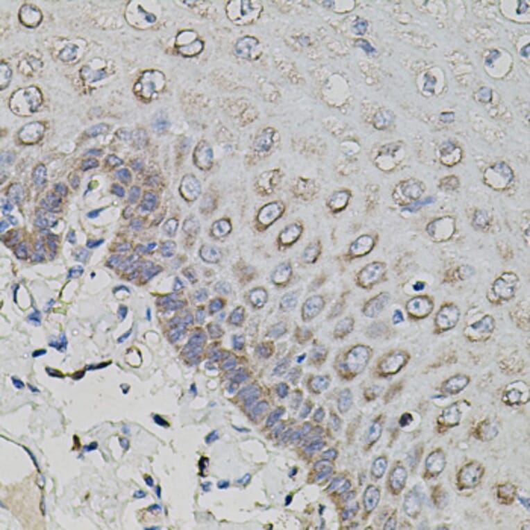 Anti Amyloid Precursor Protein Antibody A12538