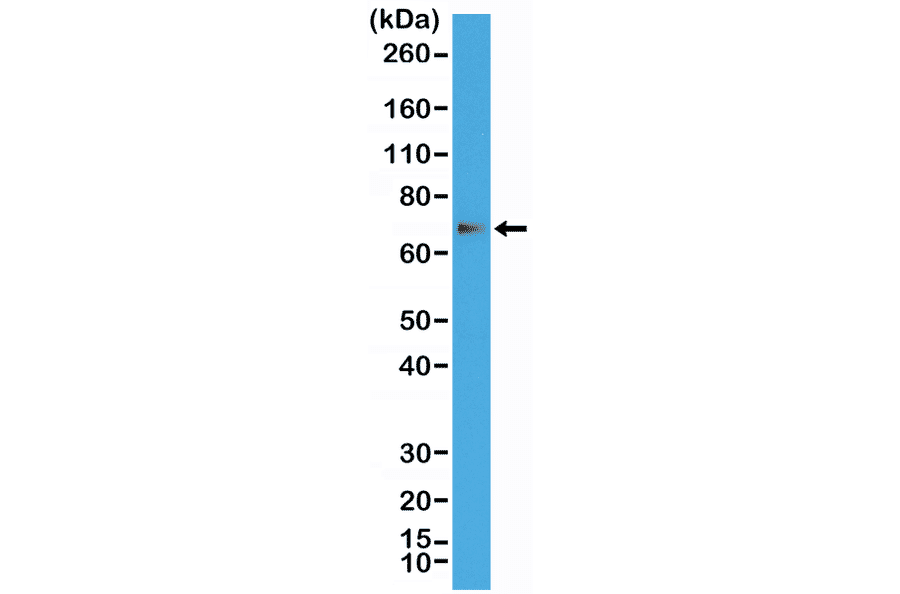 Recombinant Anti-p63 Antibody [RM383] (A121442) | Antibodies.com