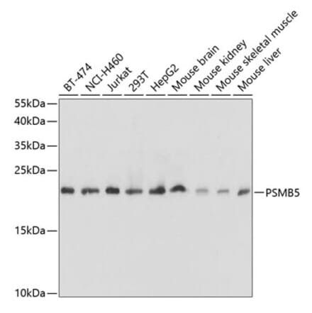 Proteasome Marker Antibodies | Antibodies.com