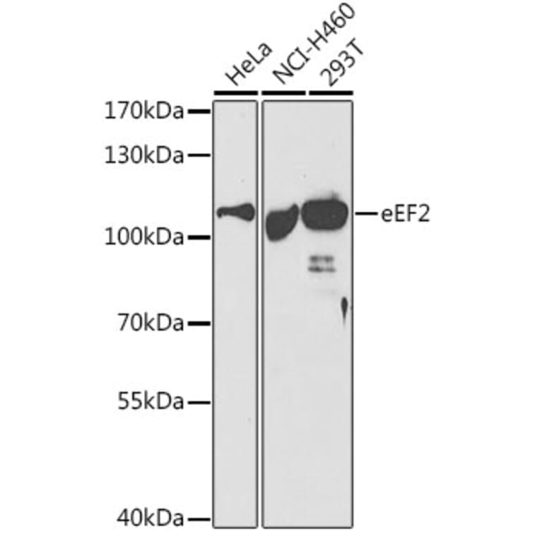Anti-EEF2/Elongation factor 2 Antibody (A13846) | Antibodies.com