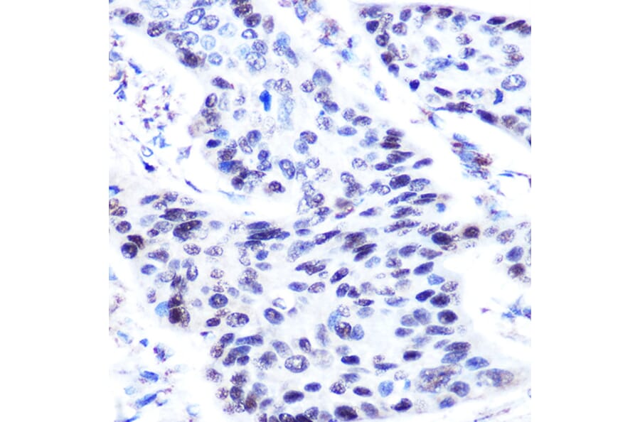 Anti-p63 Antibody (A13902) | Antibodies.com
