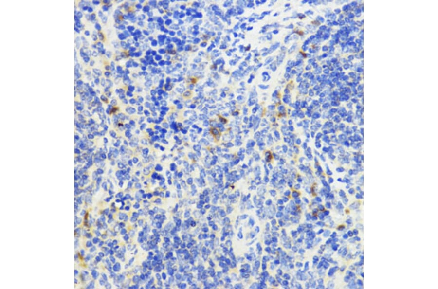 Anti-IL-10 Antibody (A13928) | Antibodies.com