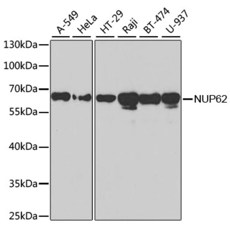 Anti-Nucleoporin p62 / NUP62 Antibody (A14011) | Antibodies.com