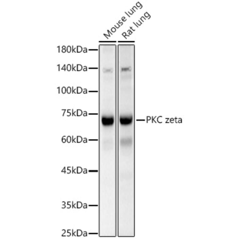 Anti-PKC zeta Anticuerpo (A14928) | Antibodies.com