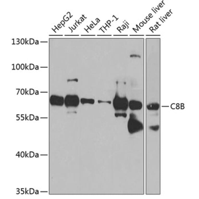 Anti-Complement factor 8 beta / C8B Antibody (A16157) | Antibodies.com