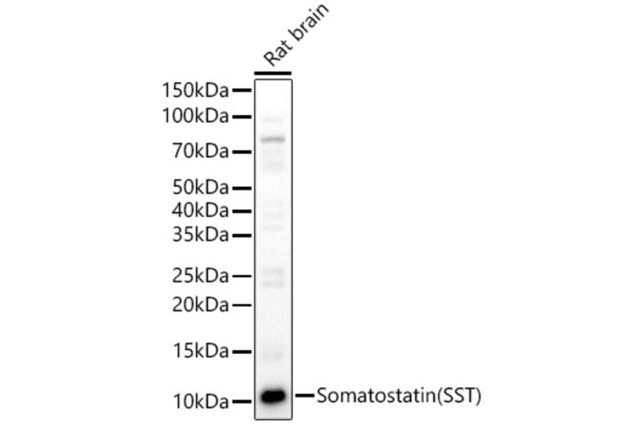 Anti Somatostatin Antibody A16303
