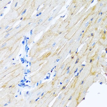 Anti-ADAM17 Antibody (A16782) | Antibodies.com Anti-ADAM17 Antibody (A16782) | Antibodies.com