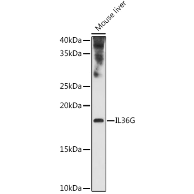 Anti-IL36 gamma/IL-1F9 Antibody (A16981) | Antibodies.com