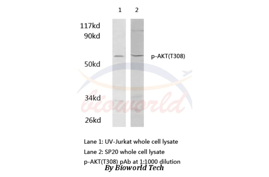 Anti-AKT (phospho-T308) Antibody (A24862) | Antibodies.com