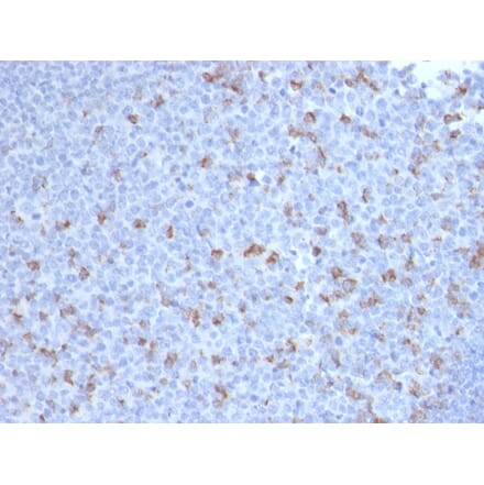 PD 1 Antibodies | Antibodies.com