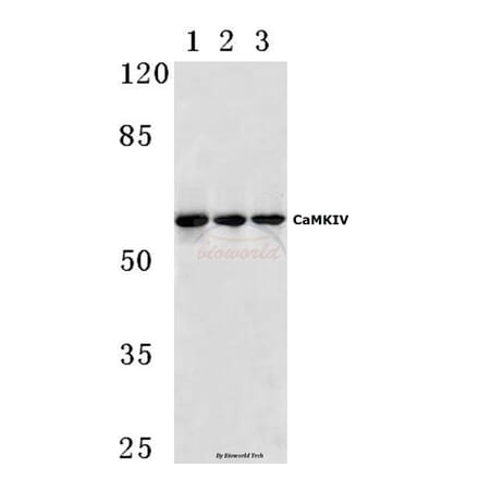CAMKIV Antibodies | Antibodies.com