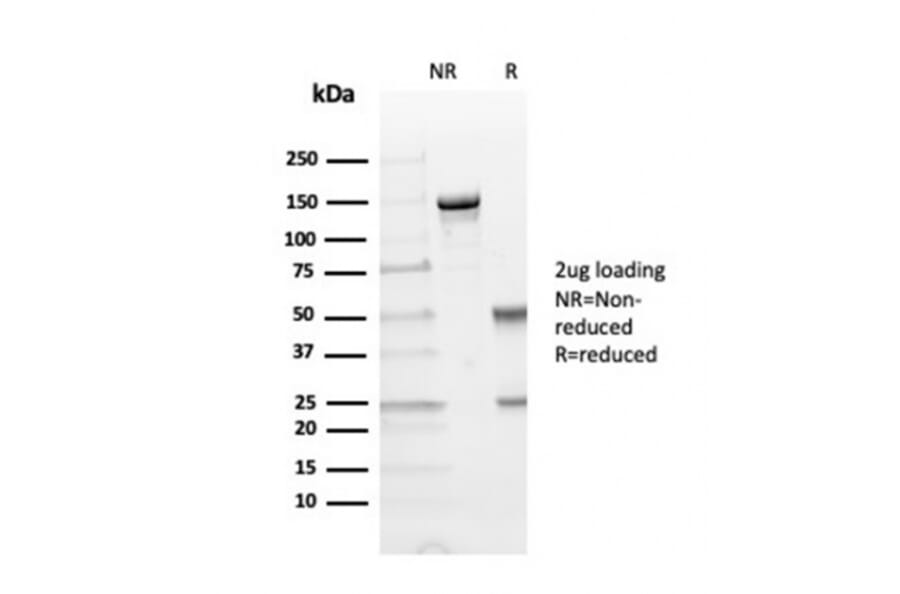 Anti-TIM3 Antibody [TIM3/4029] (A253605) | Antibodies.com