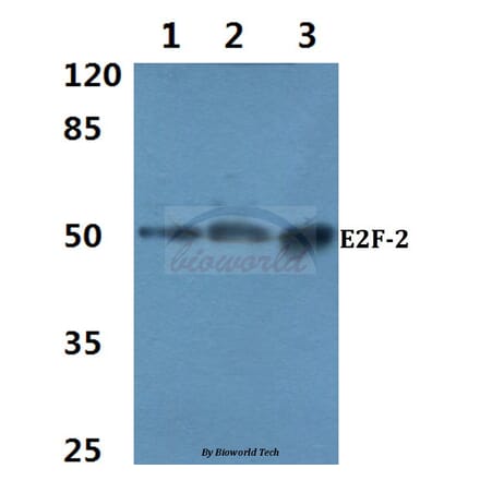 E2F2 Antibodies | Antibodies.com
