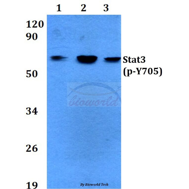Anti-Stat3 (phospho-Y705) Antibody (A27459) | Antibodies.com