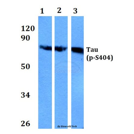 Tau Antibodies | Antibodies.com