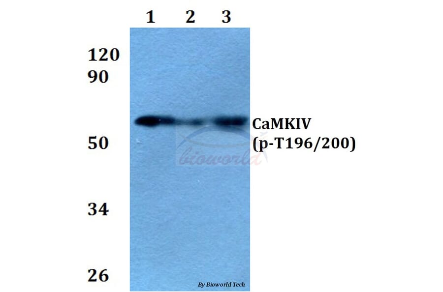 Anti-CaMKIV (phospho-T196/200) Antibody (A27543) | Antibodies.com