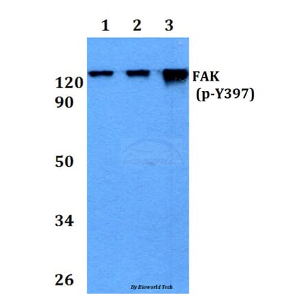 FAK Antibodies | Antibodies.com