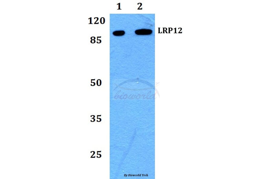 Anti-LRP12 Antibody (A28362) | Antibodies.com