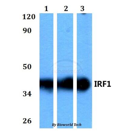 IRF1 Antibodies | Antibodies.com