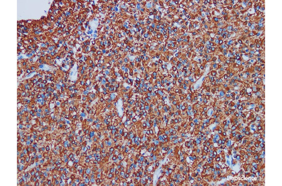 Anti-Glial Fibrillary Acidic Protein Antibody [YN00865m] (A288809)