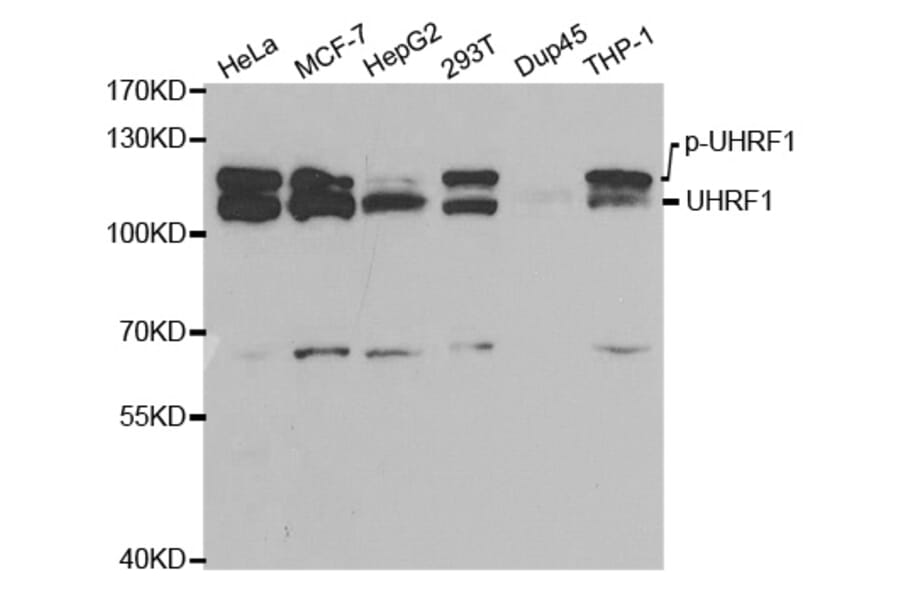 Anti-UHRF1 (ChIP Grade) Antibody (A30429) | Antibodies.com