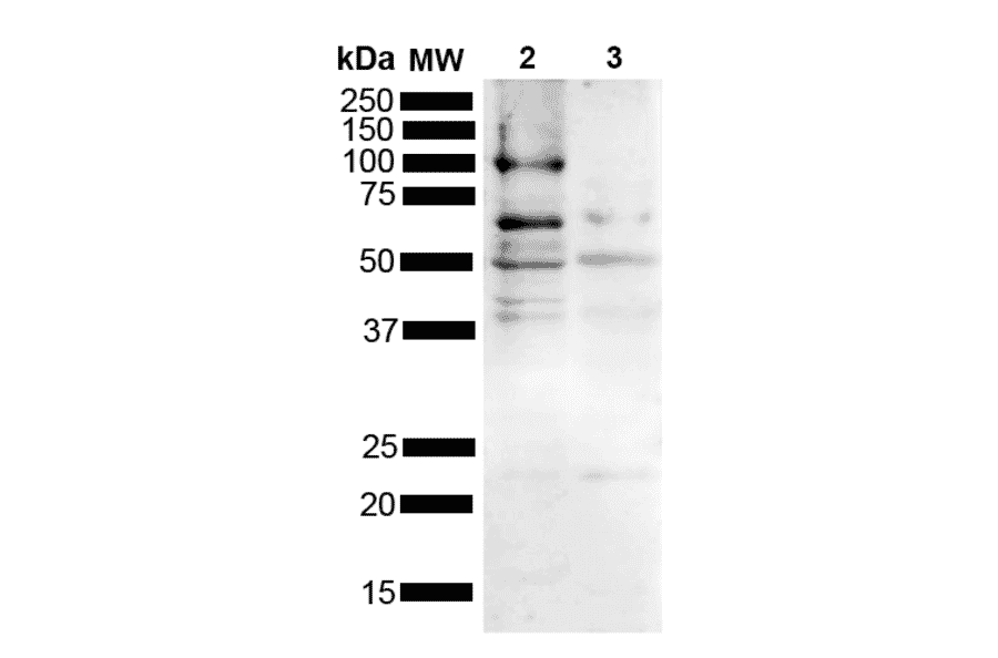 Anti-Truncated Tau Fragment (aa 297-391) Antibody (A304949)