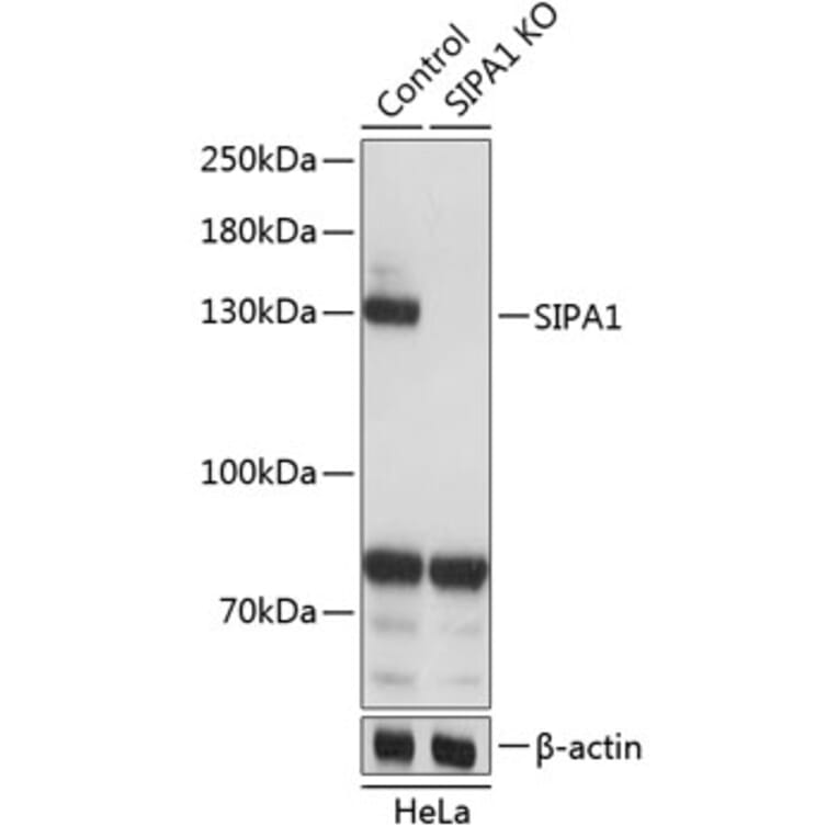 Anti-Spa-1 Antibody (A305800) | Antibodies.com