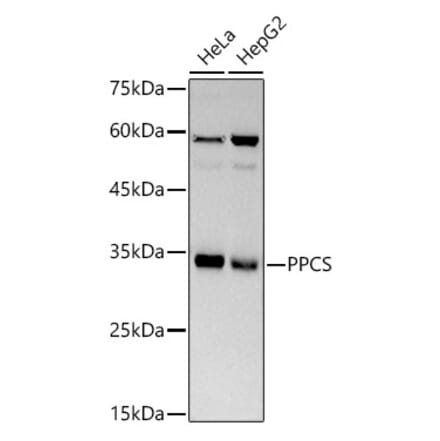 PPCS Antibodies | Antibodies.com