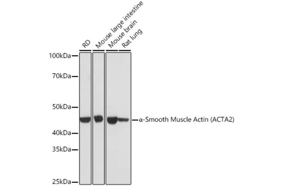 Anti-alpha smooth muscle Actin Antibody [ARC0298] (A307100)