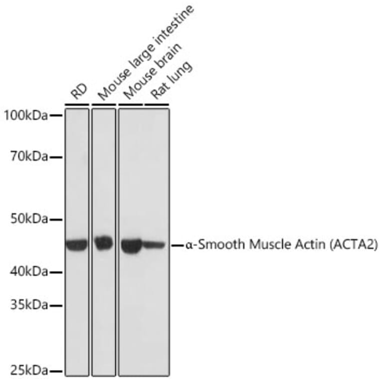 Anti-alpha smooth muscle Actin Antibody [ARC0298] (A307100)