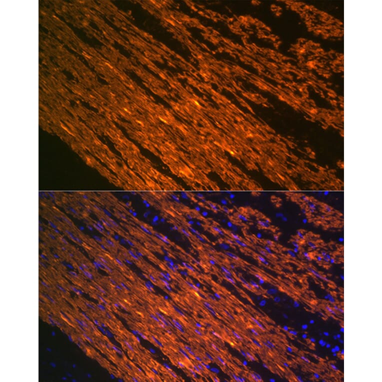 Anti-alpha smooth muscle Actin Antibody [ARC0298] (A307100)
