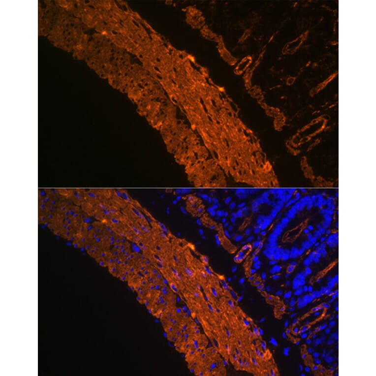 Anti-alpha smooth muscle Actin Antibody [ARC0298] (A307100)