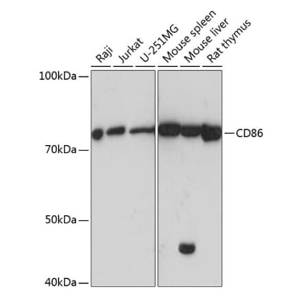 CD86 Antibodies | Antibodies.com