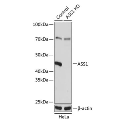 ASS1 Antibodies | Antibodies.com