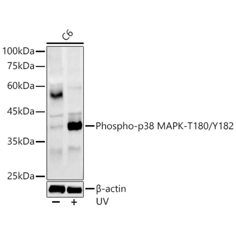 Anti-p38 MAPK (phospho Thr180 + Tyr182) Antibody (A307919)