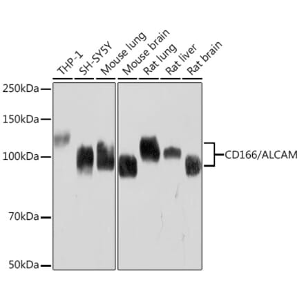 CD166 Antibodies | Antibodies.com
