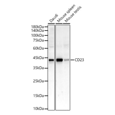 CD23 Antibodies | Antibodies.com