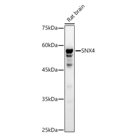 SNX4 Antibodies | Antibodies.com