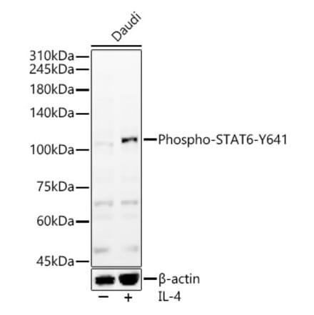 STAT6 Antibodies | Antibodies.com