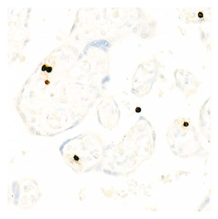 CD66b Antibodies | Antibodies.com