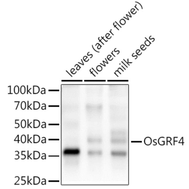 Anti-GRF4 Antibody (A309824) | Antibodies.com